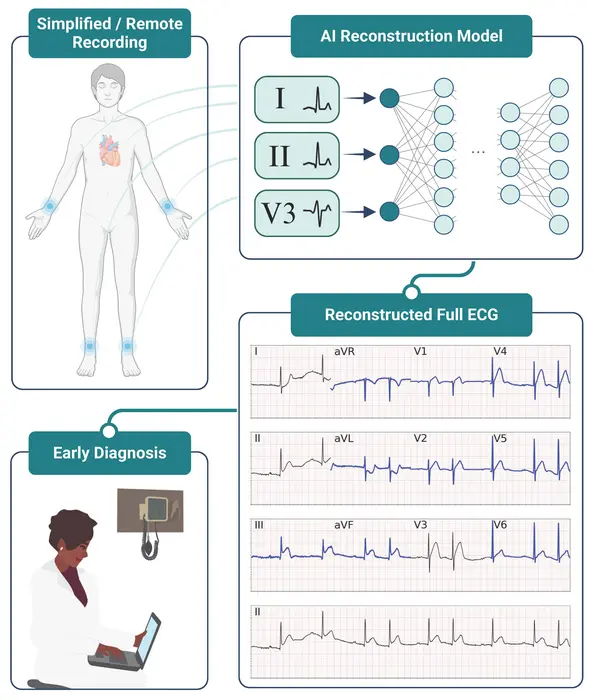 Ecg Leads View Of Common ECG Lead Placement Errors. Part I: Limb Lead